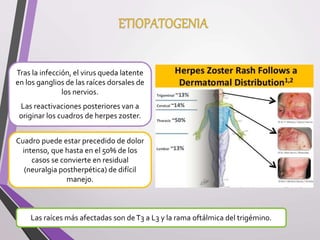 Herpes zoster y sindrome de ramsay hunt | PPTX