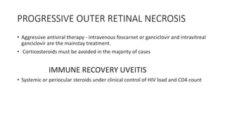 Herpetic viral retinitis | PPTX