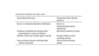 Herpetic viral retinitis | PPTX