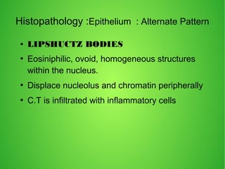 Herpes Simplex RC | ODP