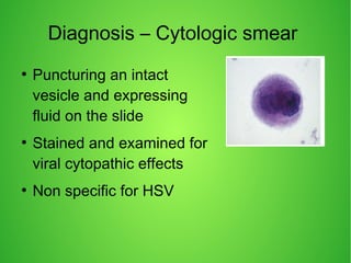 Herpes Simplex RC | ODP | Infectious Diseases | Diseases and Conditions