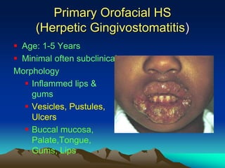 Her simplex Wart Molluscum.ppt