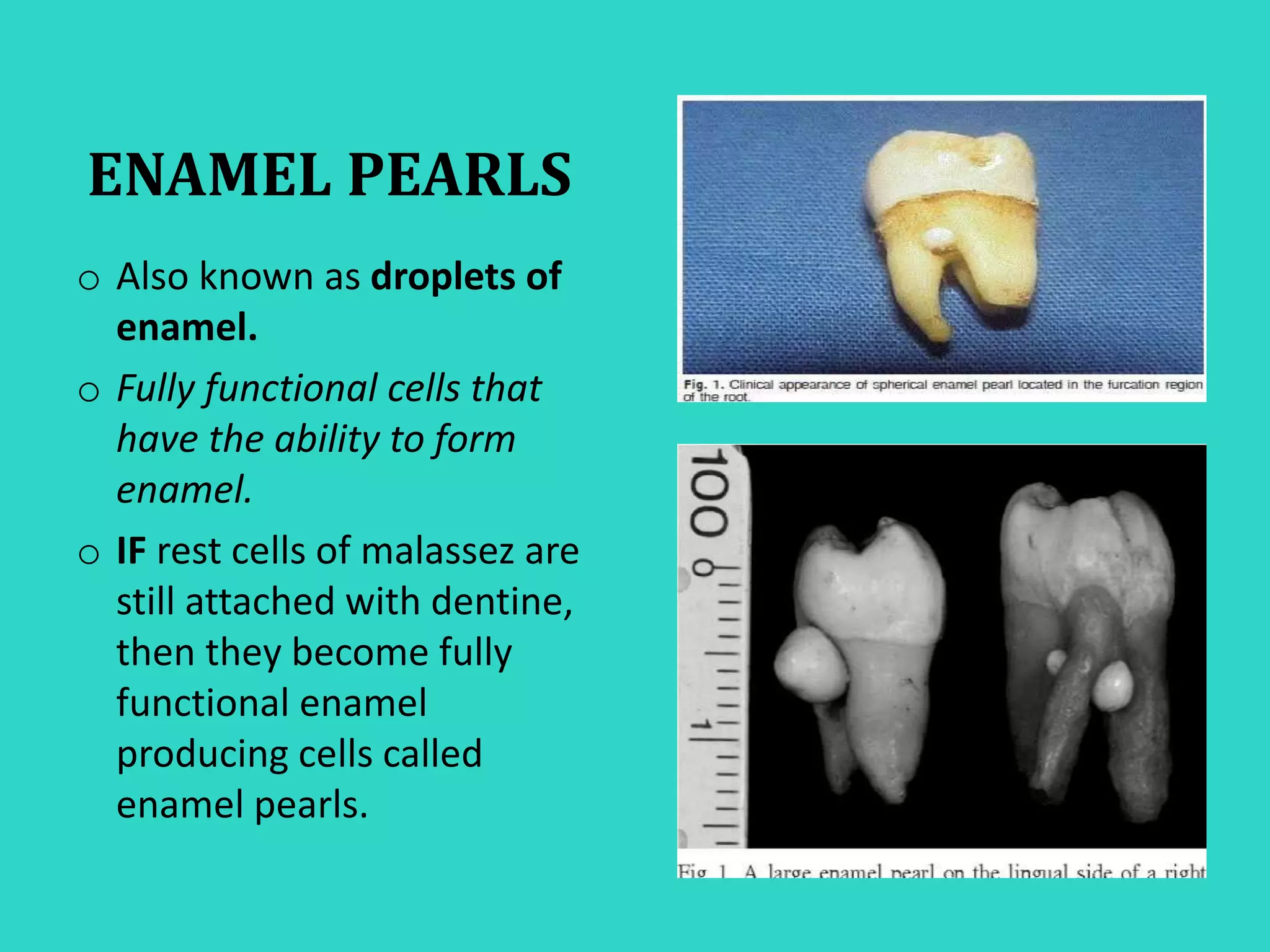 HERTWIG’S EPITHELIAL ROOTH SHEATH | PPTX