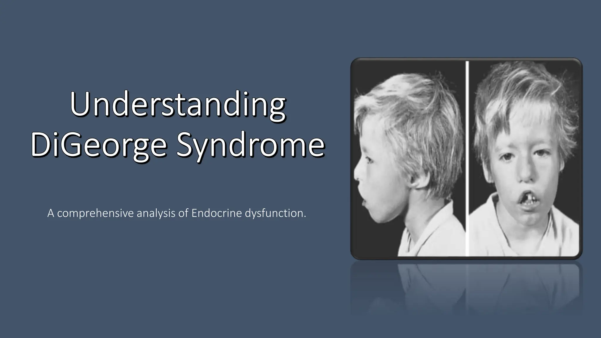 The Di George Syndrome Endocrinology.pptx