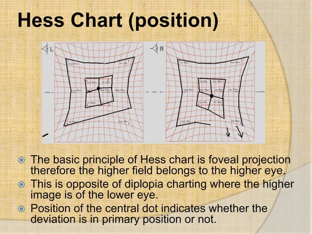 Hess chart