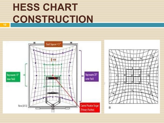 Hess chart | PPTX | Eye and Vision Conditions | Diseases and Conditions