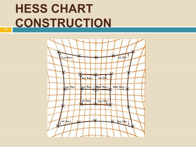 Hess chart | PPTX | Eye and Vision Conditions | Diseases and Conditions