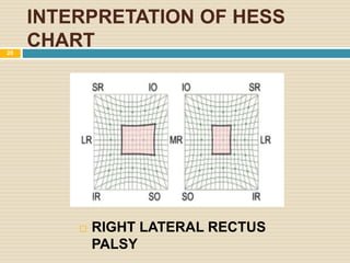 Hess chart | PPTX