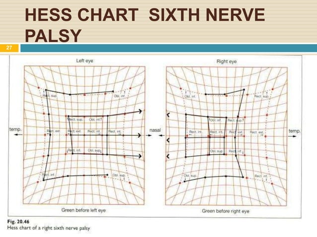 Hess chart | PPT