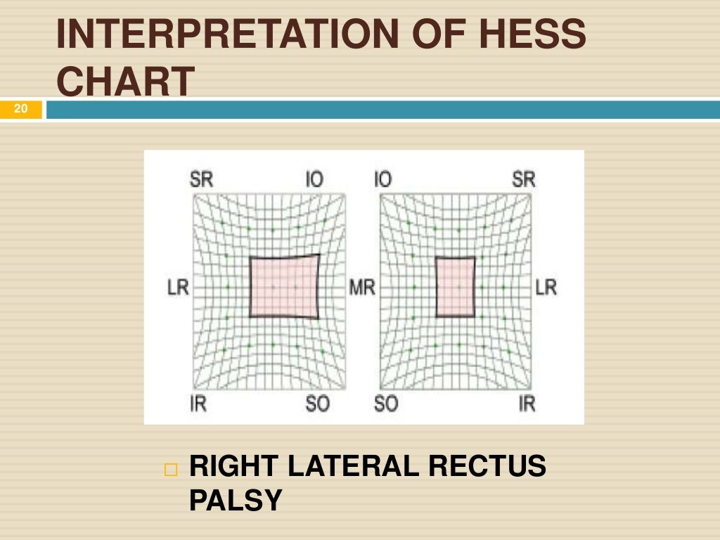 Hess chart