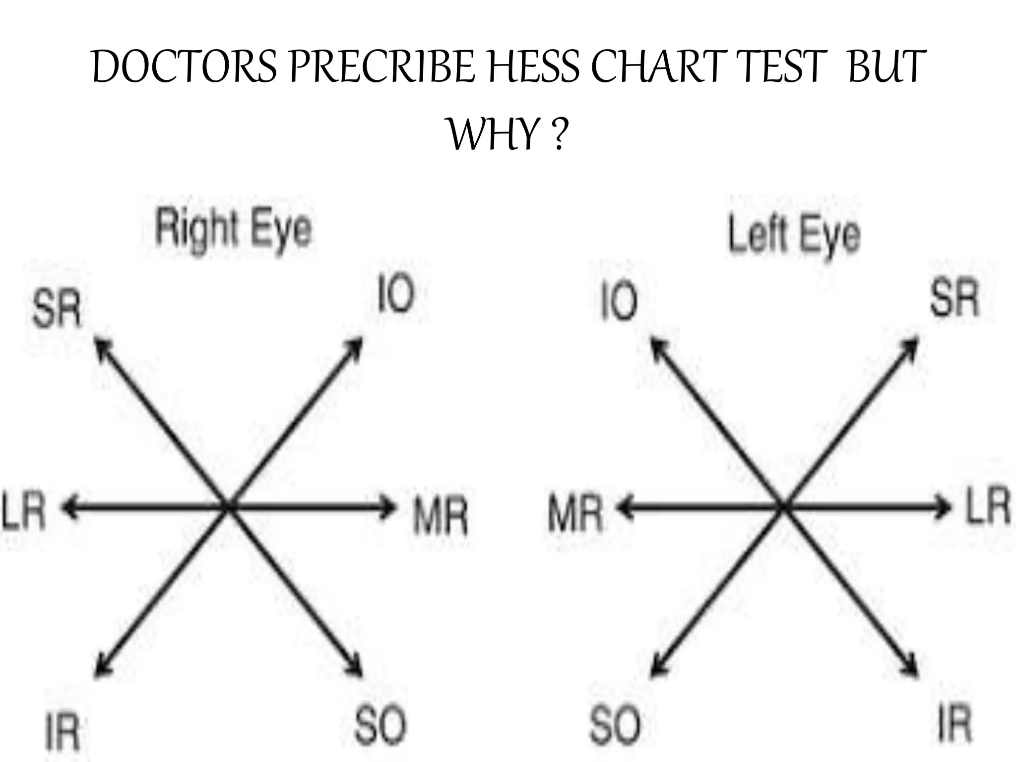 Hess chart | PPTX