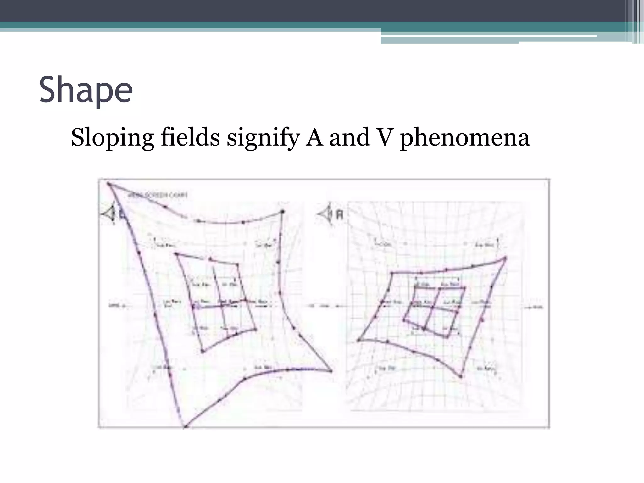 Hess chart and it's Interpretation | PPTX