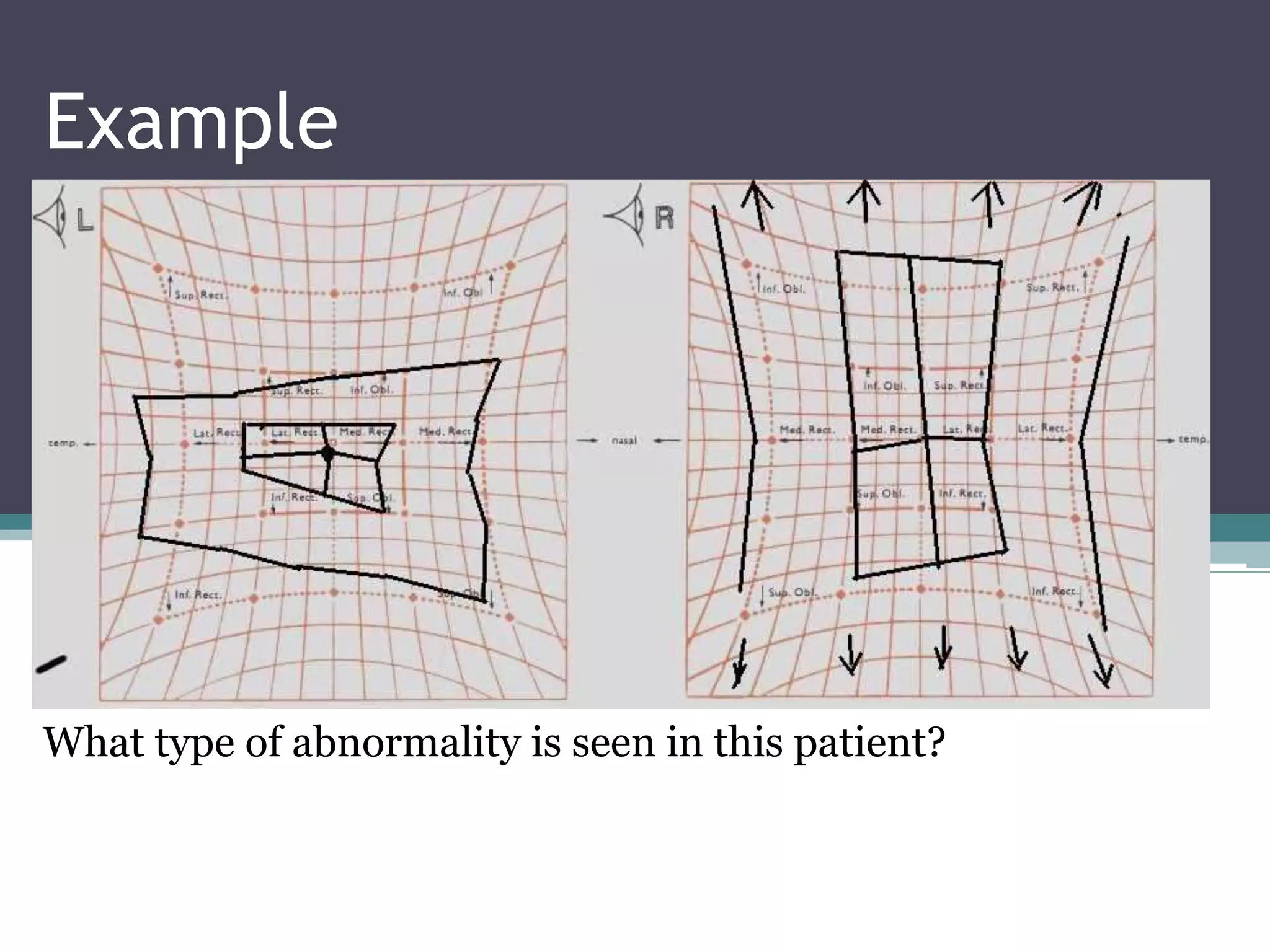 Hess chart and it's Interpretation | PPTX