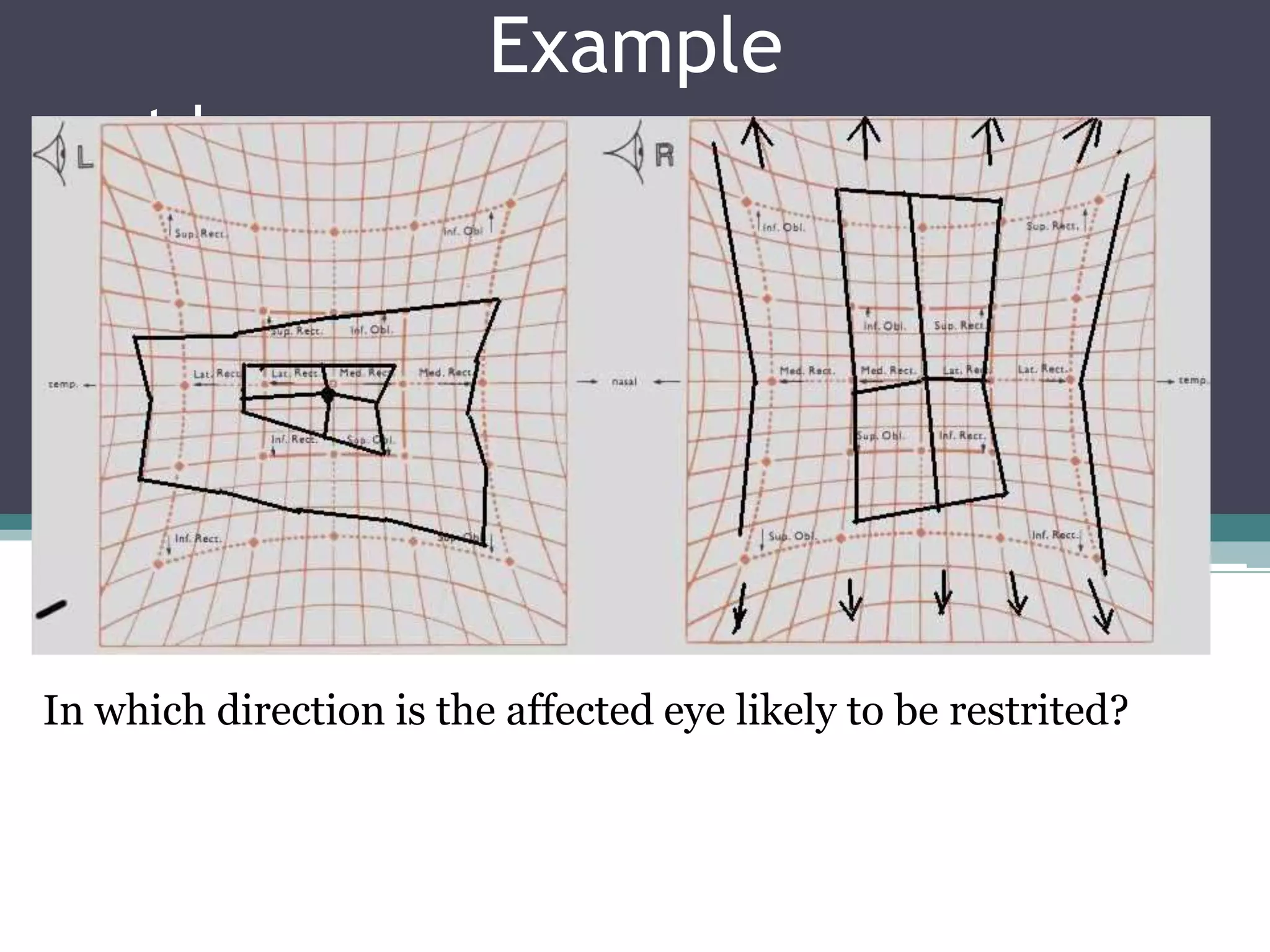 Hess chart and it's Interpretation | PPTX