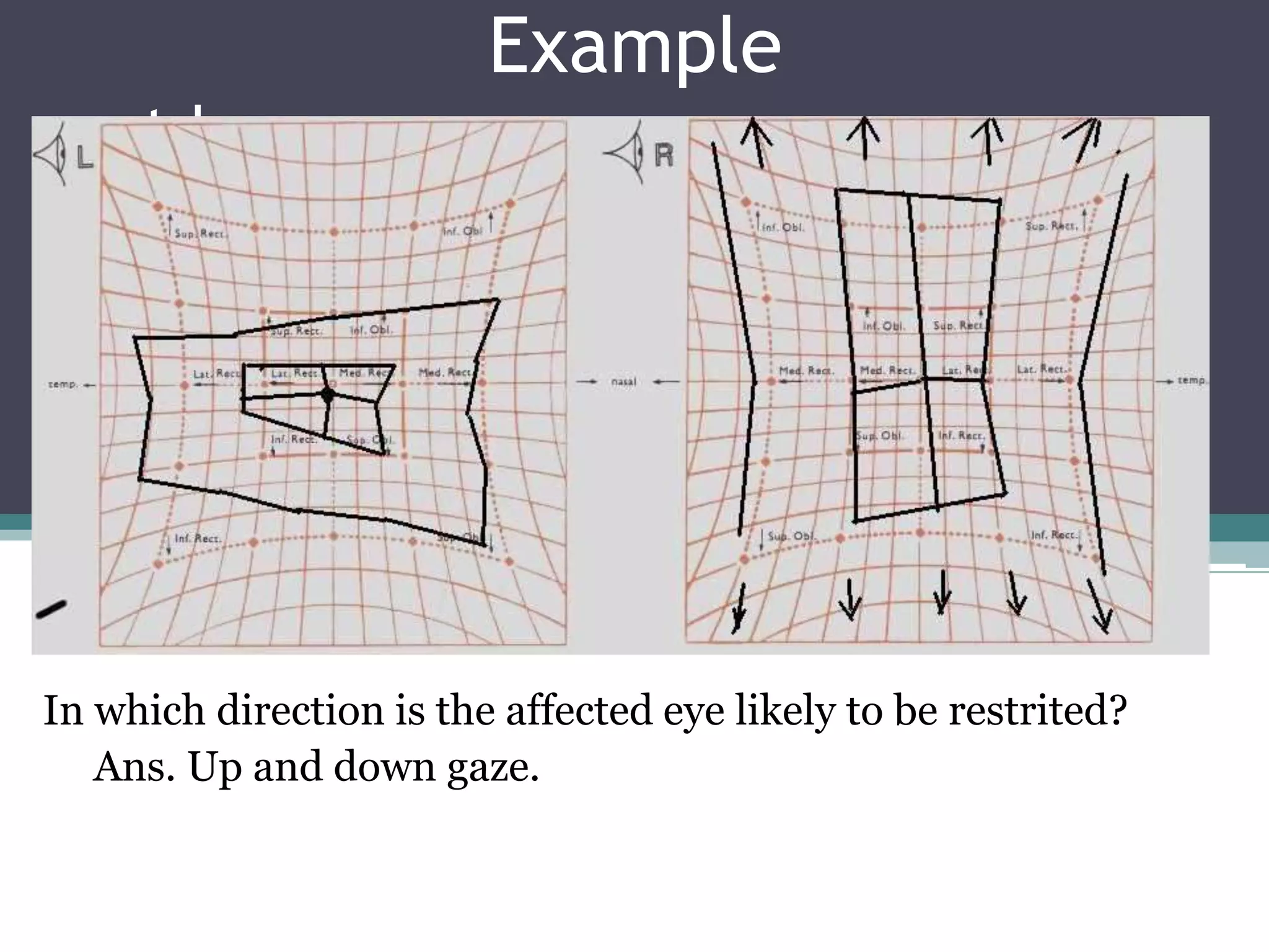 Hess chart and it's Interpretation | PPTX
