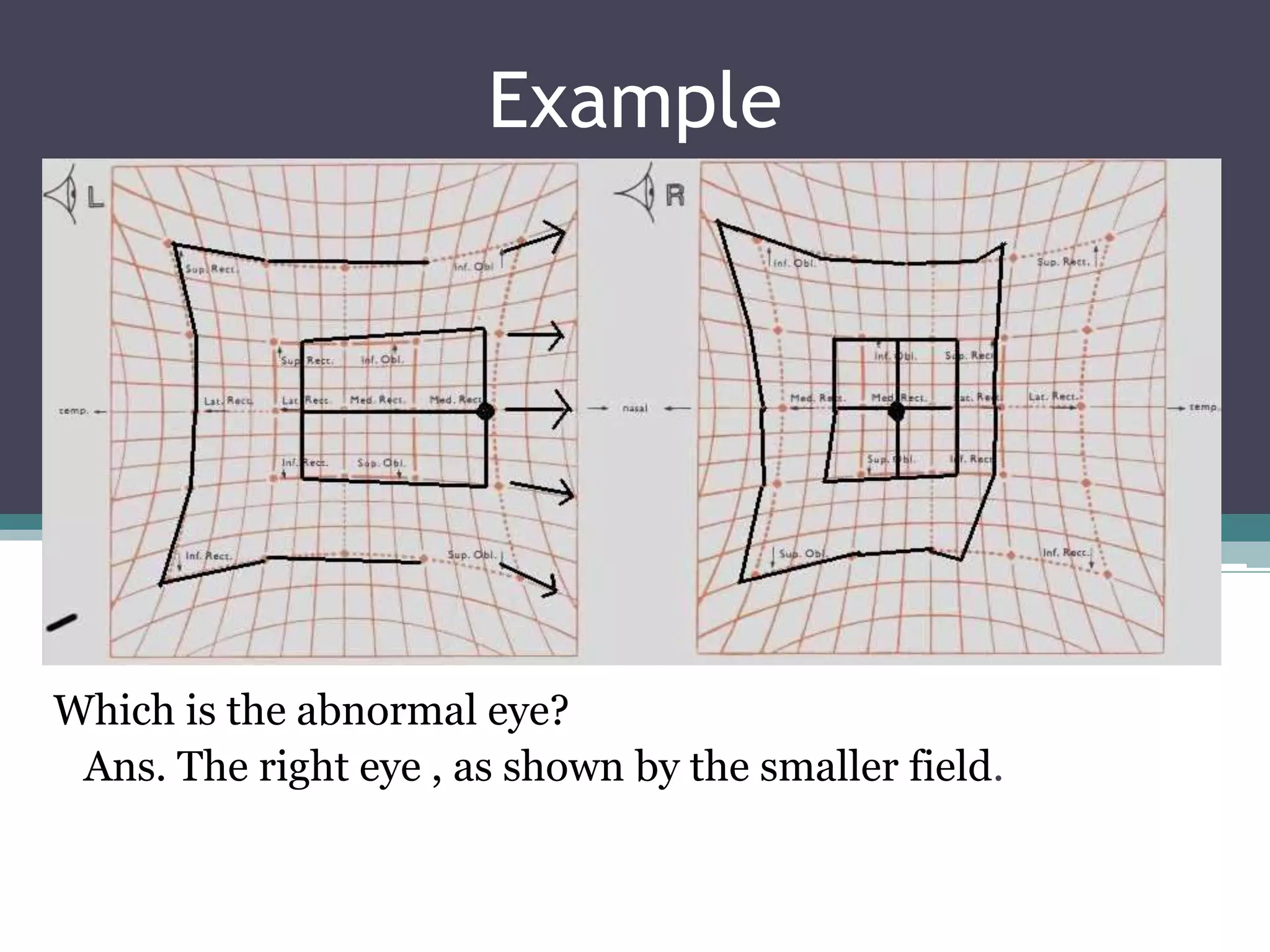 Hess chart and it's Interpretation | PPTX