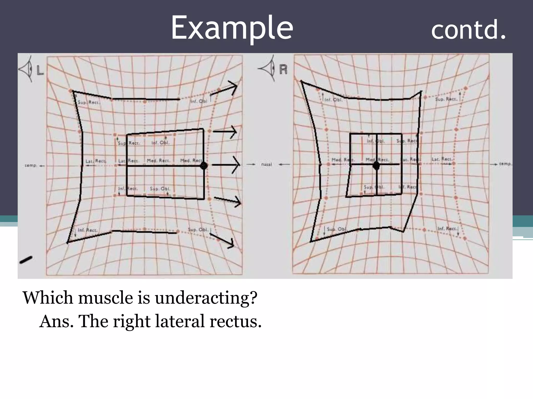 Hess chart and it's Interpretation | PPTX