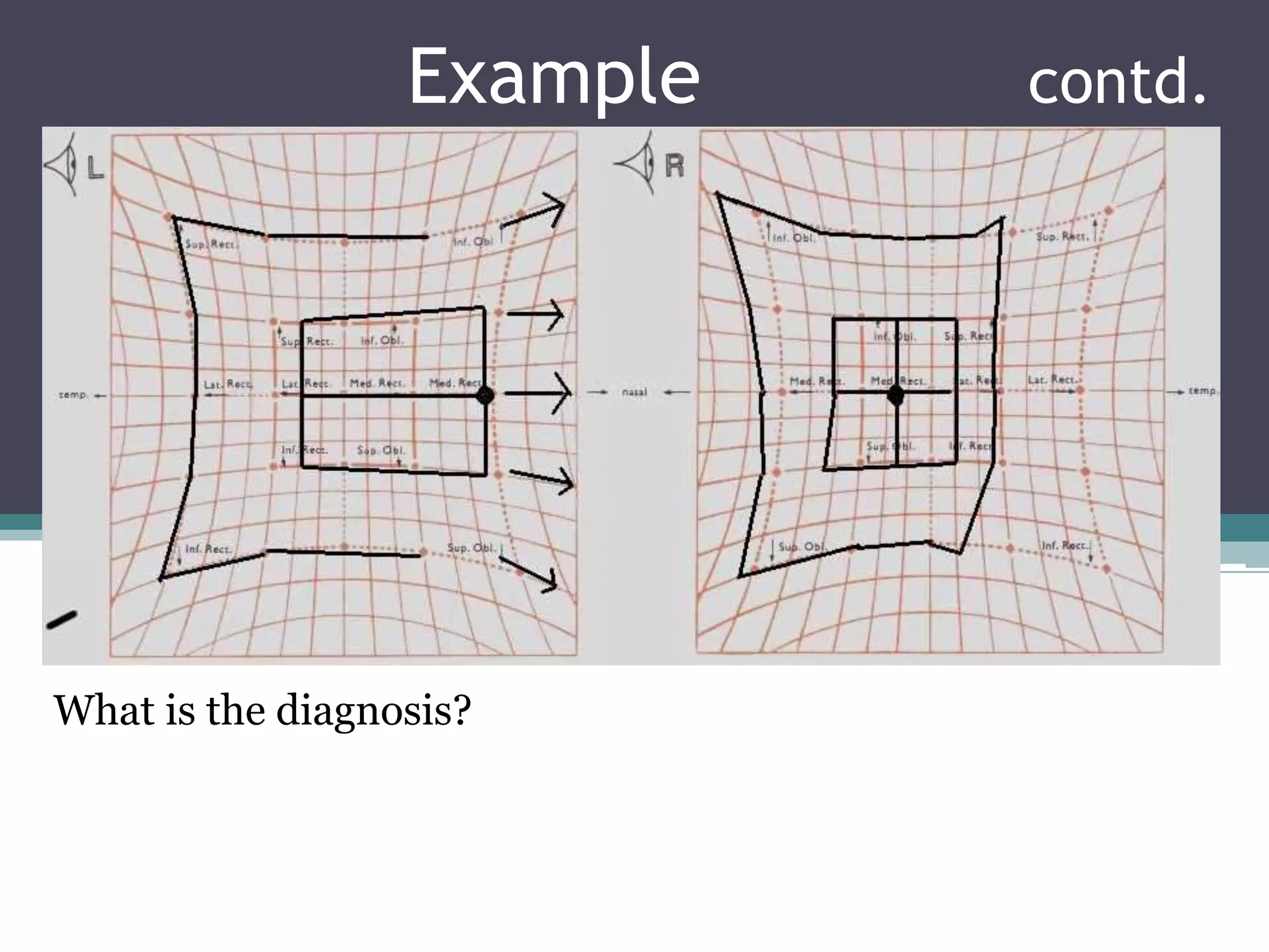 Hess chart and it's Interpretation | PPTX