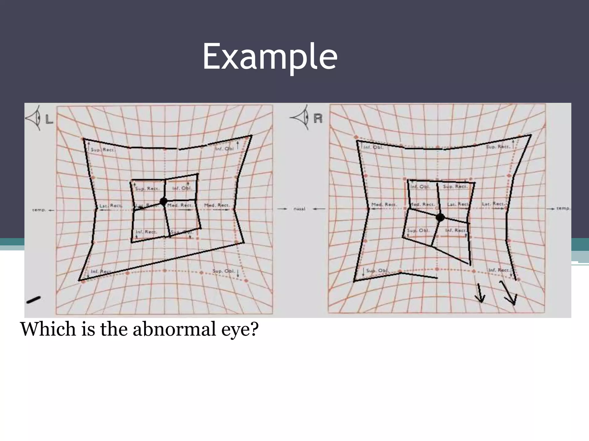 Hess chart and it's Interpretation | PPTX
