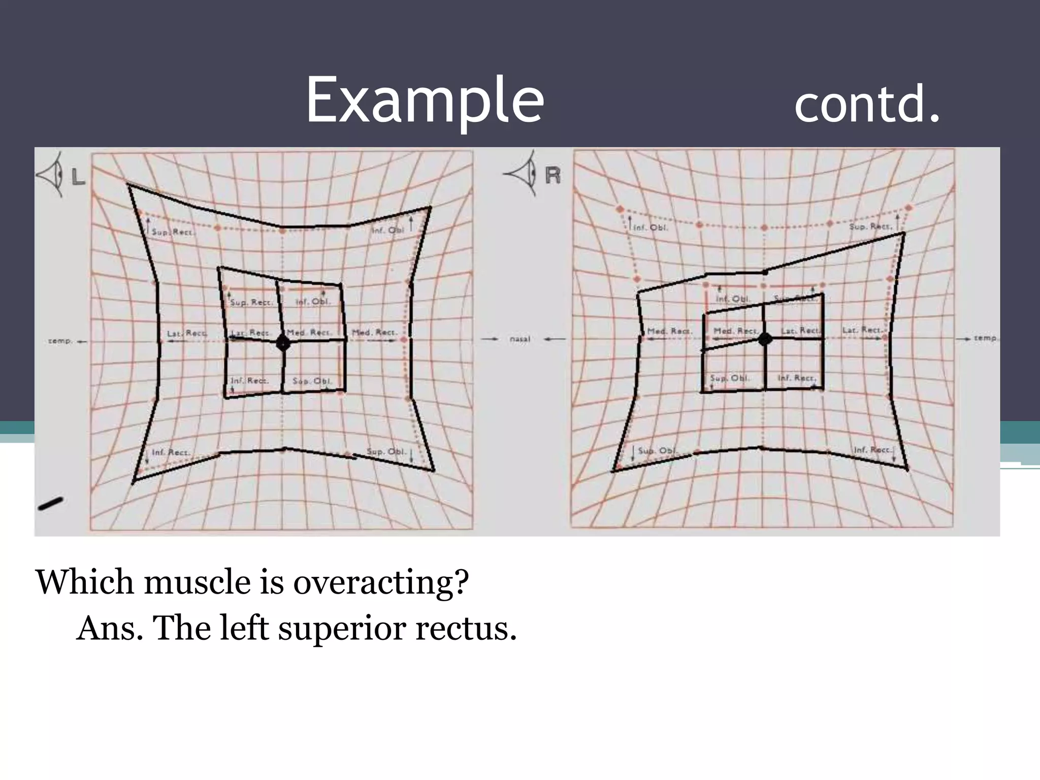 Hess chart and it's Interpretation | PPTX