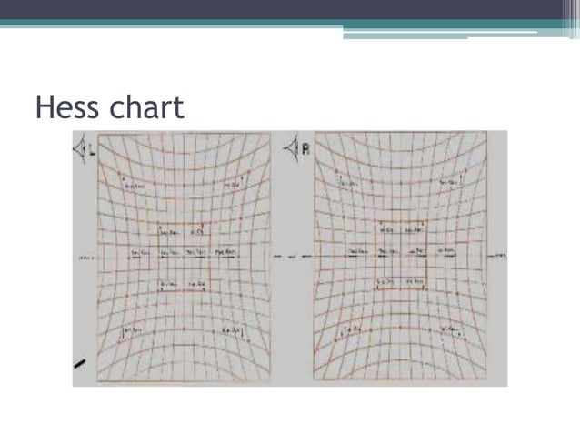 Hess chart and it's Interpretation | PPTX