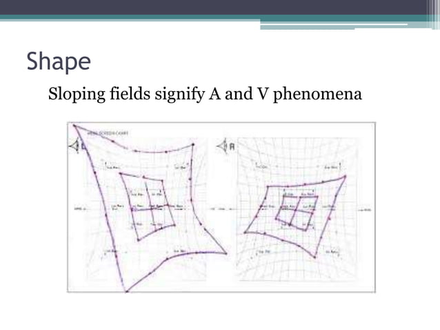 Hess chart and it's Interpretation | PPTX