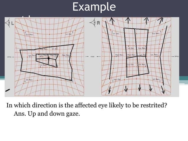 Hess chart and it's Interpretation | PPTX
