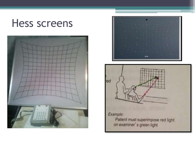 Hess chart and it's Interpretation | PPTX