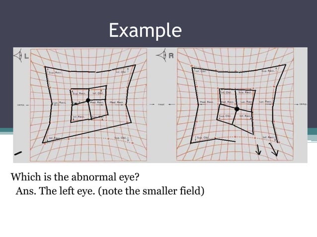 Hess chart and it's Interpretation | PPTX