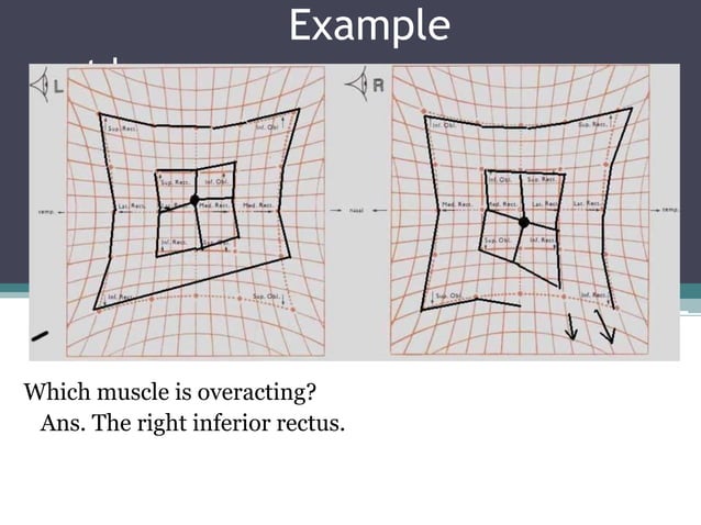 Hess chart and it's Interpretation | PPTX