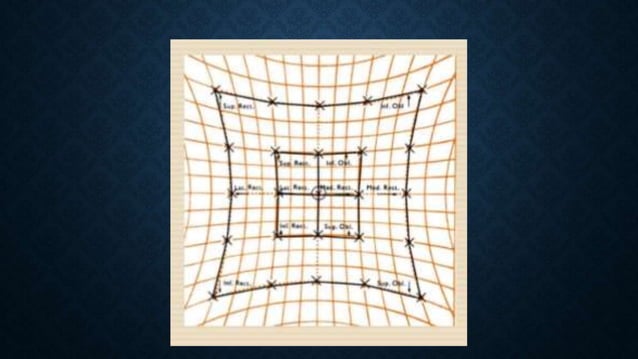 Hess chart, diplopia chart, cover tests | PPTX