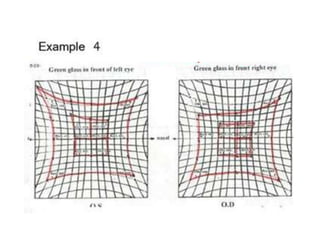 Hess charting | PPTX
