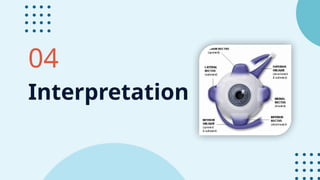 Hess Screen Test Explained: Methodology, Applications & Clinical ...