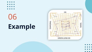 Hess Screen Test Explained: Methodology, Applications & Clinical ...