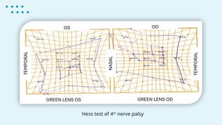 Hess Screen Test Explained: Methodology, Applications & Clinical ...