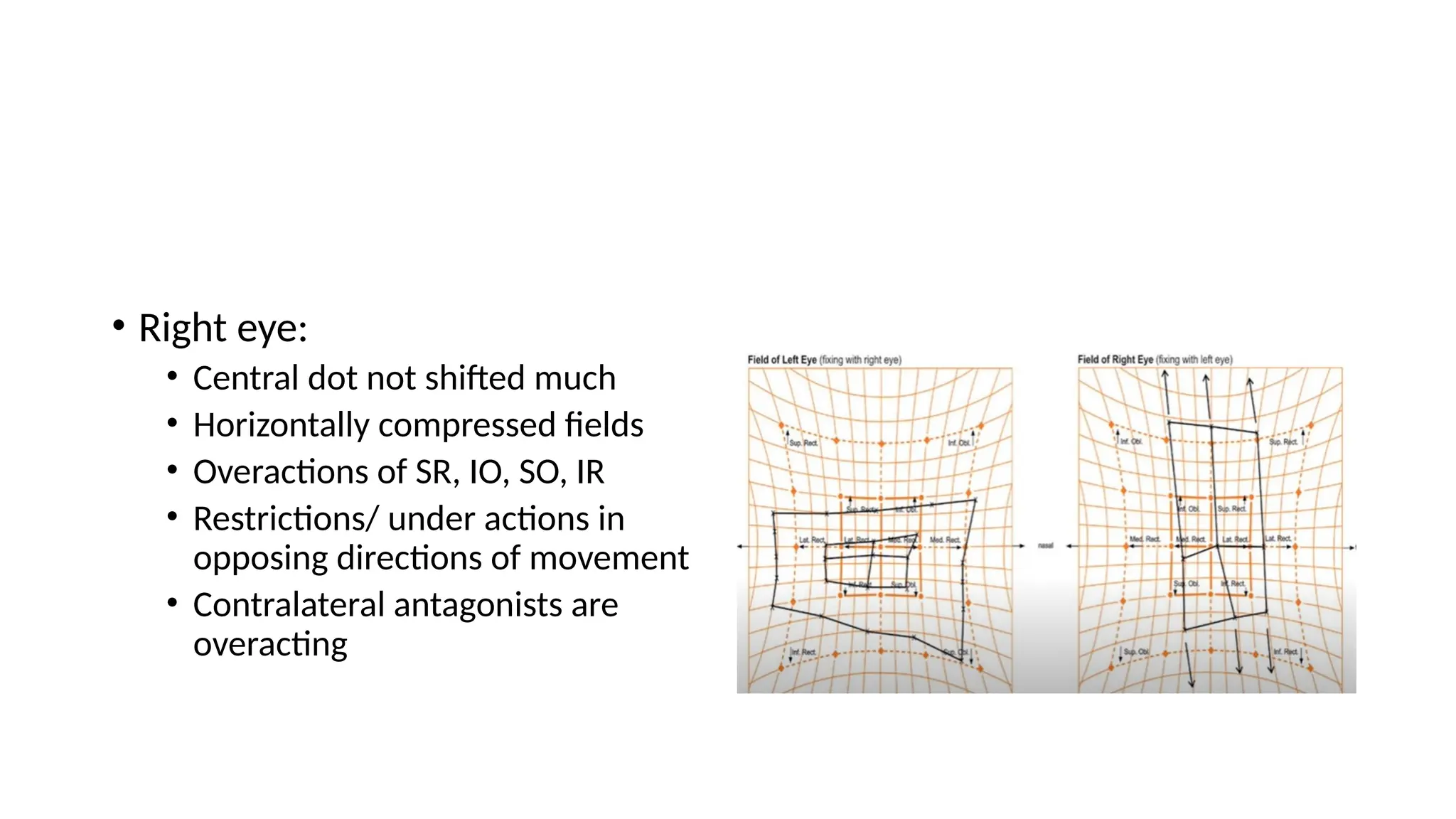 Hess test-1 presentation for eye doctors pptx | PPTX
