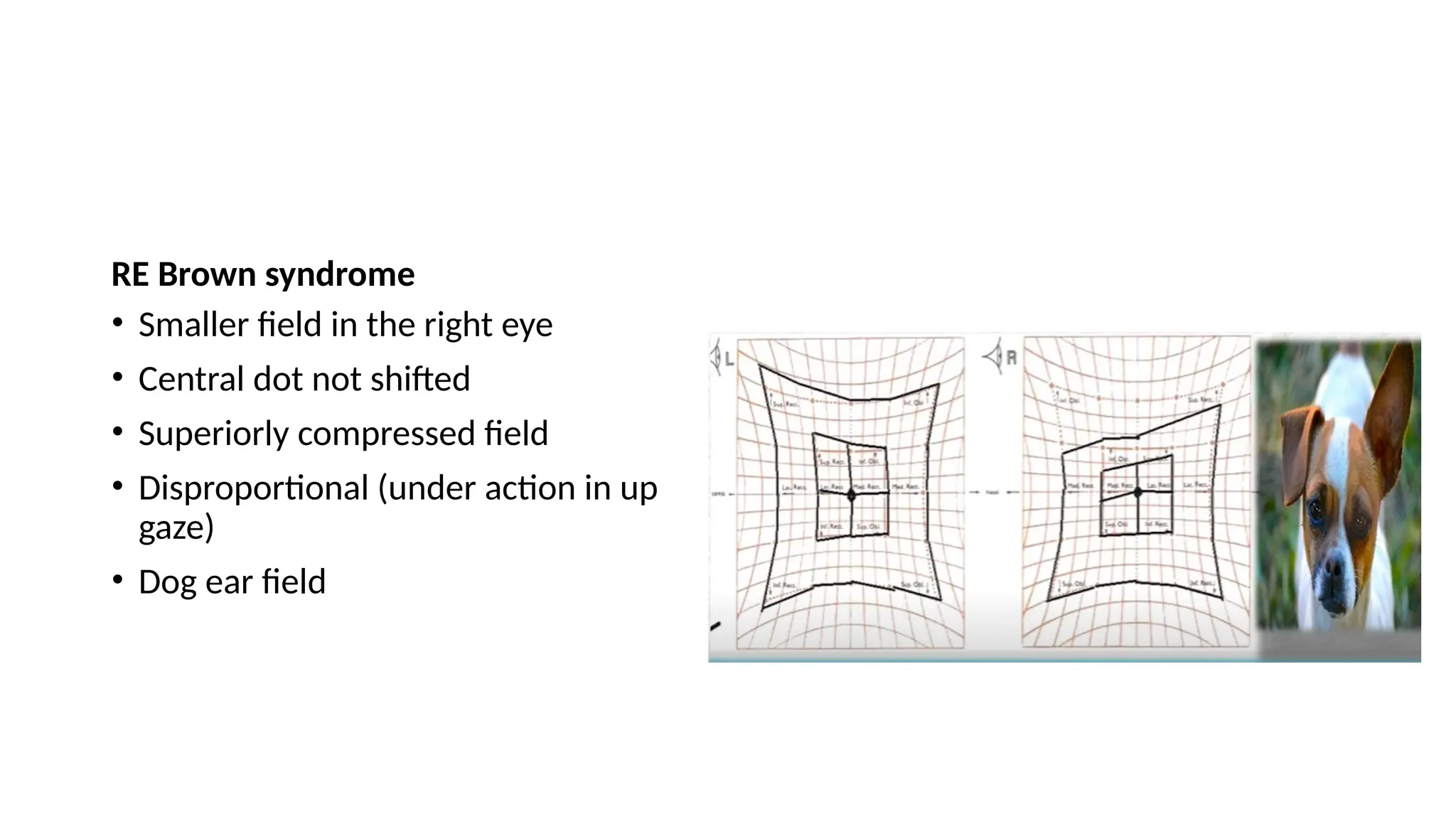 Hess test-1 presentation for eye doctors pptx | PPTX