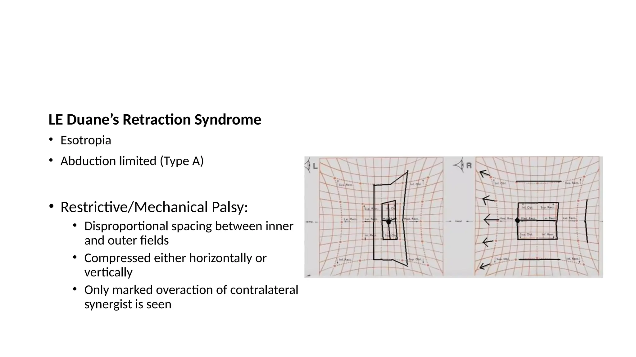 Hess test-1 presentation for eye doctors pptx | PPTX