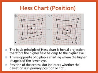Hess test | PDF