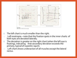 Hess test | PDF