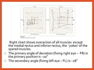 Hess test | PDF
