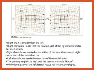 Hess test | PDF