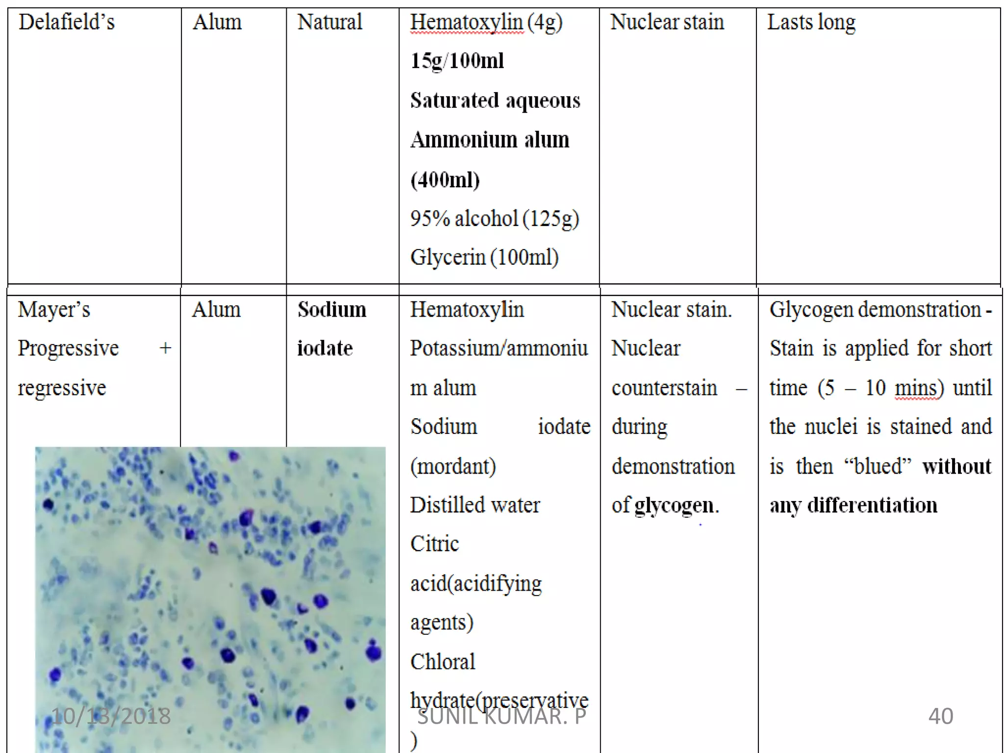 Hematoxylin and Eosin Staining (H& E Staining) | PPTX | Blood Disorders | Diseases and Conditions