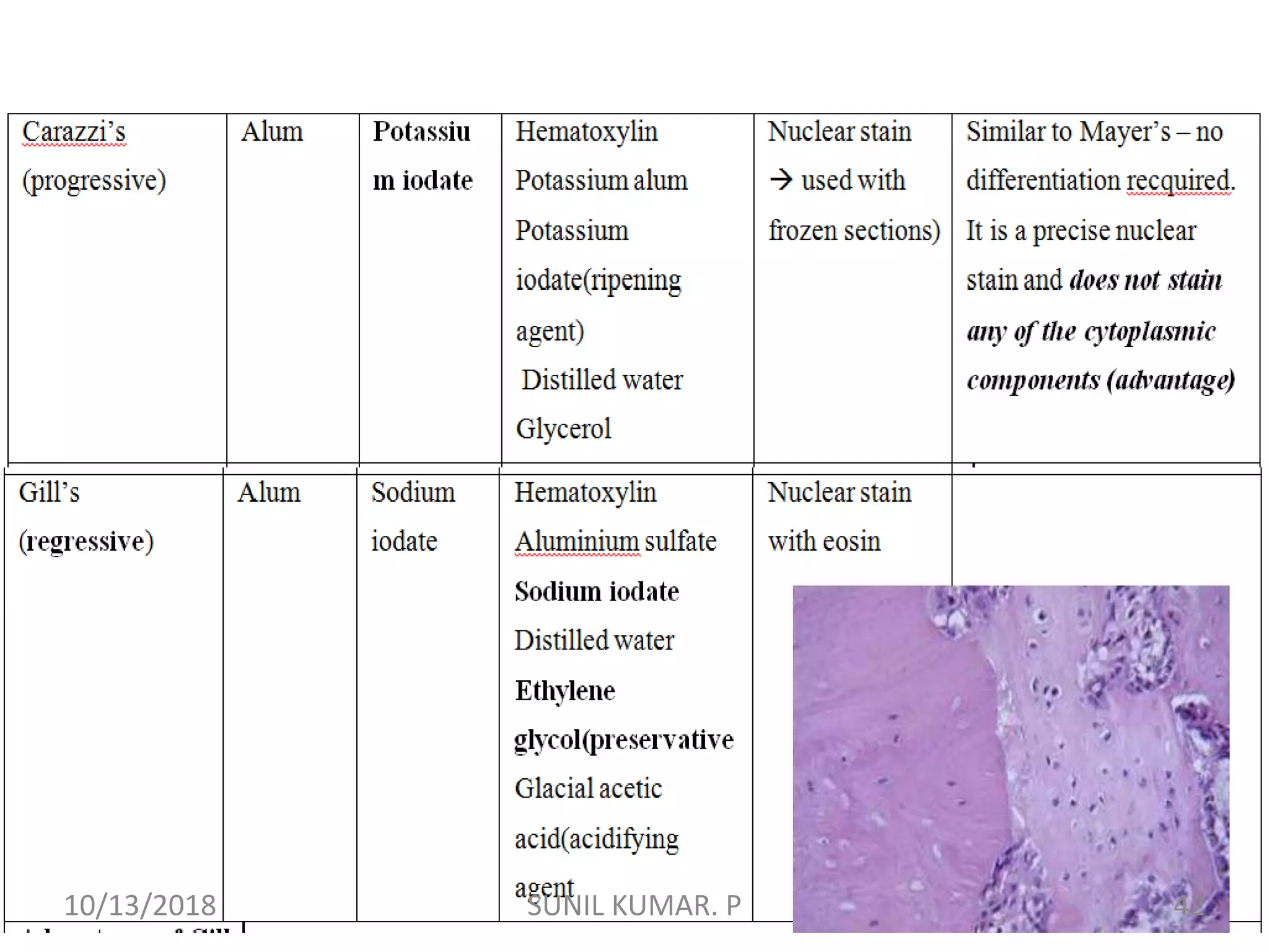 Hematoxylin and Eosin Staining (H& E Staining) | PPTX | Blood Disorders | Diseases and Conditions