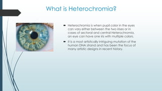 Heterochromia | PPT