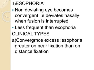 Heterophoria;Definiton,classification and etiology | PPTX