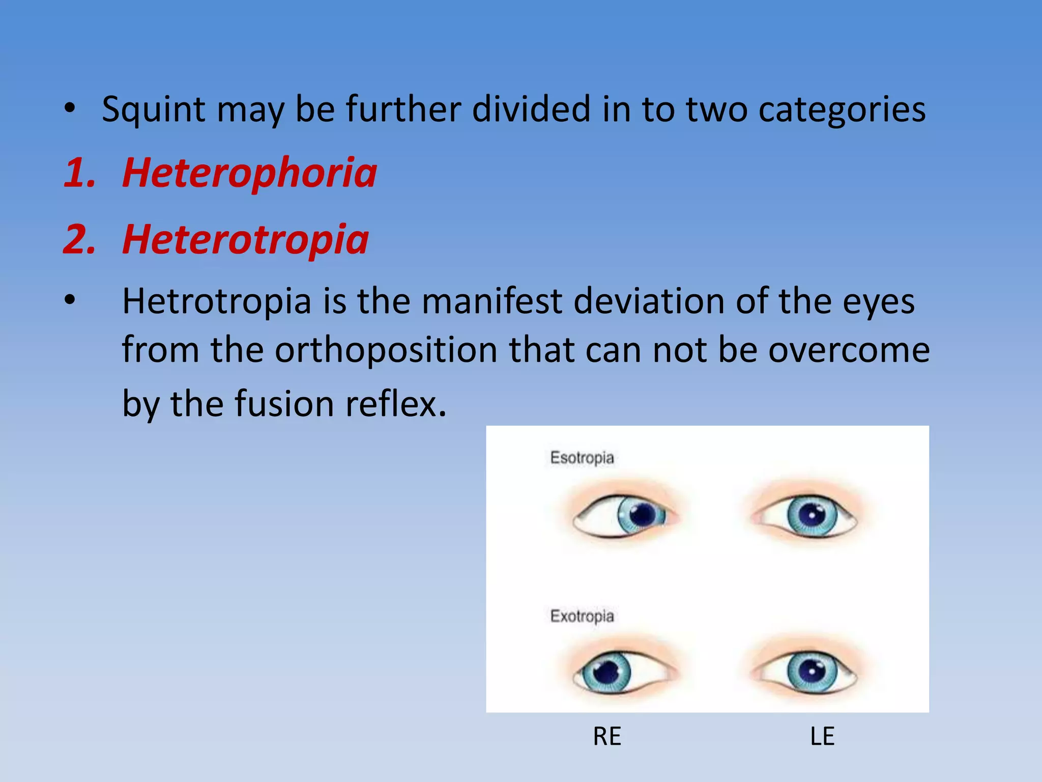 Heterophoria Or Latent Squint | PPTX