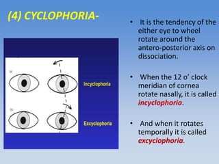 Heterophoria Or Latent Squint | PPTX