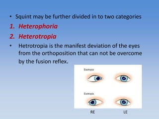 Heterophoria Or Latent Squint | PPTX