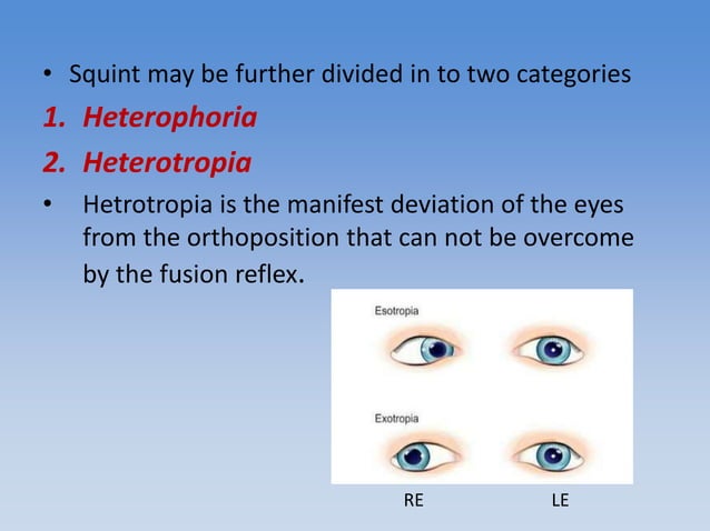 Heterophoria Or Latent Squint | PPTX